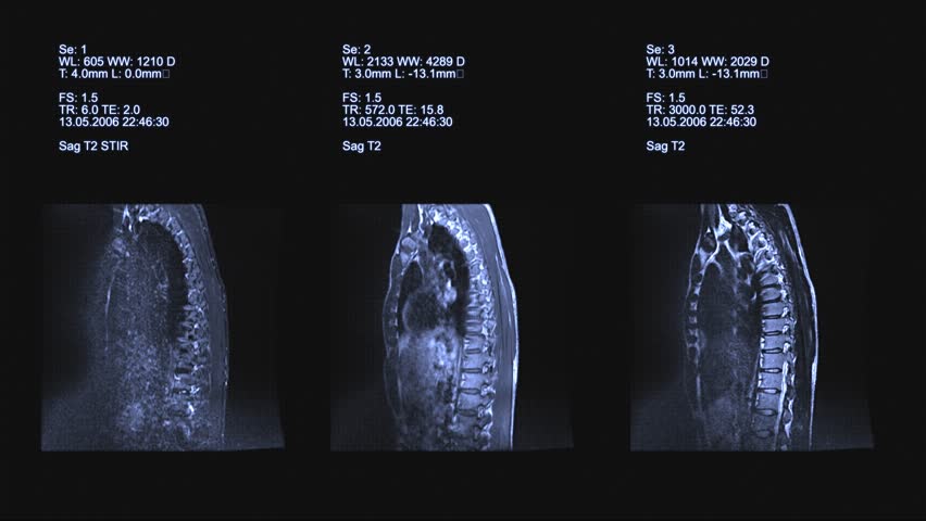 4k Blue Medical Background. Video Showing MRI, Charts, Numbers And Data ...