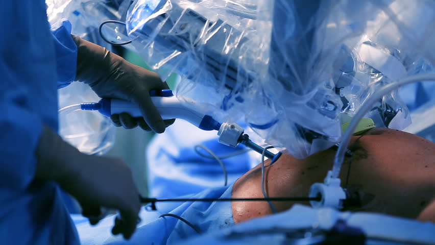 Rib Retractors Opened For Heart Surgery Záběr Video 1900273 | Shutterstock