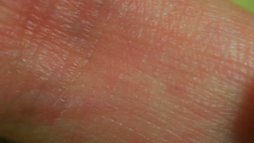 Skin cells Stock Video Footage - 4K and HD Video Clips | Shutterstock